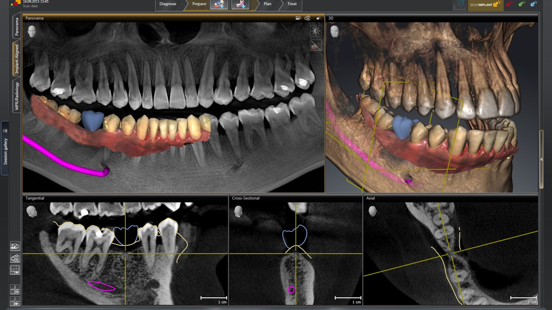 Logiciel SICAT Dental | Dentsply Sirona CH